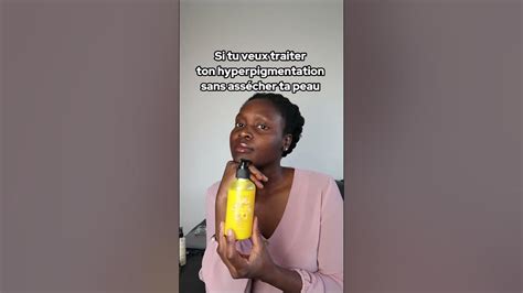 Lhyperpigmentation Buzz Viral Hyperpigmentation Skincareroutine