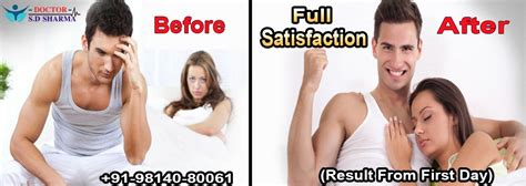 Sex Power Increase Your Sex Power Herbal Treatment Dr SD Sharma
