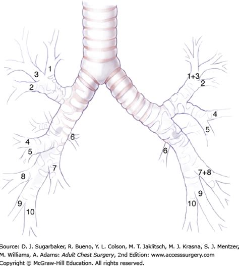 Segmentectomy For Primary Lung Cancer Thoracic Key