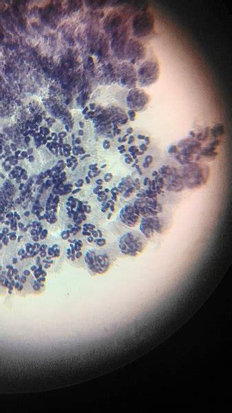 What Is The Difference Between Diplotene And Diakinesis Pediaa Com