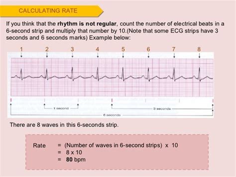 Ch Calculating Heart Rate Flashcards Quizlet