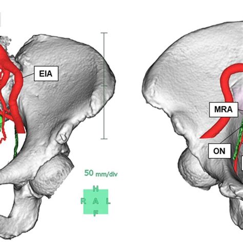 Comparison Between The 3d Reconstruction Image And Intraoperative