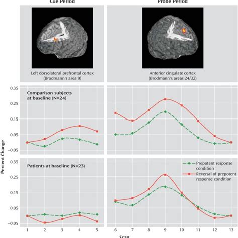 Dorsolateral Prefrontal Cortex And Anterior Cingulate Cortex Activity Download Scientific