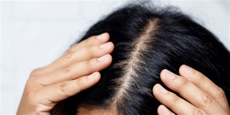 Why Does My Scalp Itch After Applying Oil Likefigures