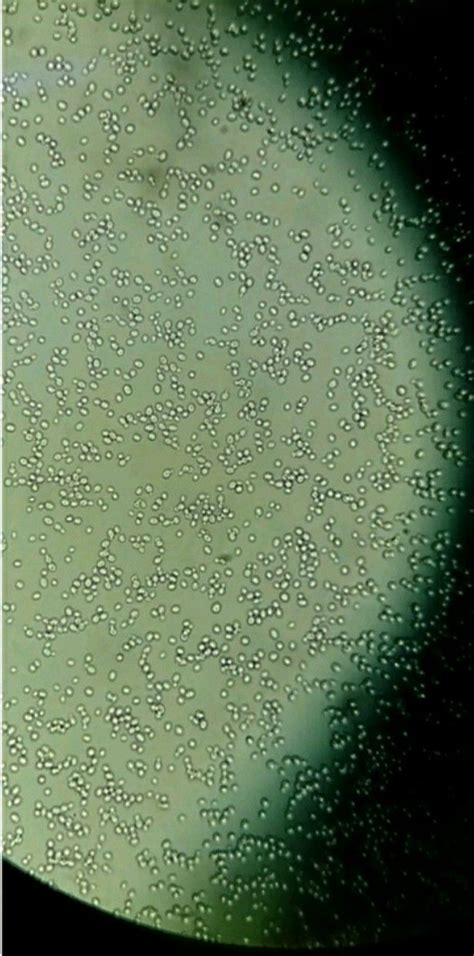 El Belghiti Fatima Ezzahra On Linkedin Candida Albigans