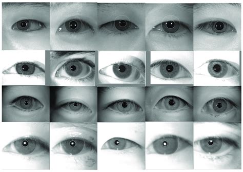 typical iris localization results obtained using the proposed method on