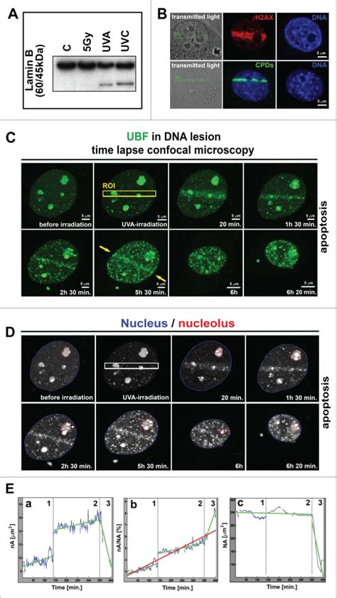 Localized Movement And Morphology Of Ubf1 Positive Nucleolar Regions