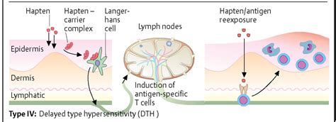 Hypersensitivity Introduction Causes Mechanism And Types