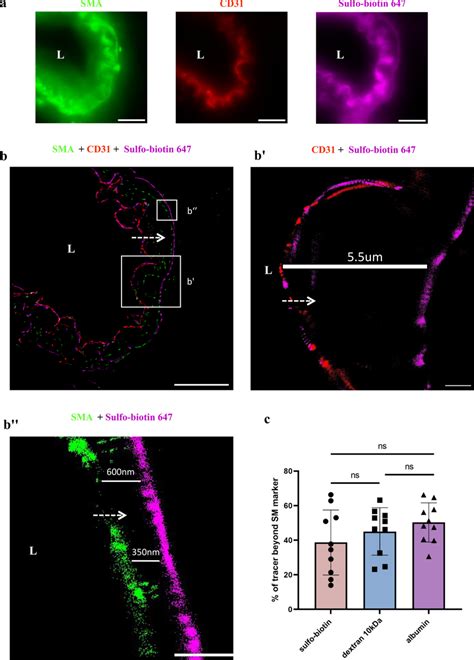Dstorm Imaging Demonstrates Super Resolution Tracer Permeability And