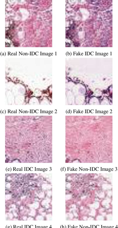 Figure 3 From Synthetic Data Augmentation Using Gan For Improved Breast Cancer Classiﬁcation