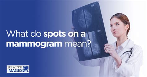 What Do Spots On A Mammogram Mean Health Images