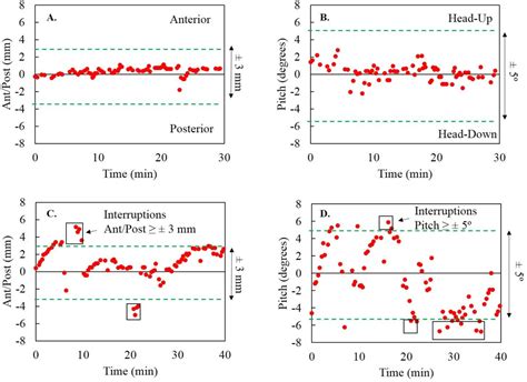 Figure 1 From Impact Of Intrafractional Prostate Motion On The Accuracy And Efficiency Of