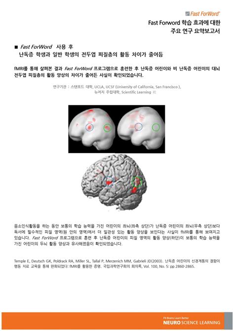 Fast Forword 학습효과에 대한 주요연구 내용 요약 뇌과학영어 패스트포워드 언론보도 연구 논문 요약 미국 자료 소개 등
