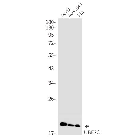 Ubiquitin Conjugating Enzyme E2 C Rabbit Mab Wb Ihc P Ihc F Ip