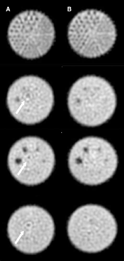 Phantom Images From Vertex Intrinsic Uniformity Corrected Images A