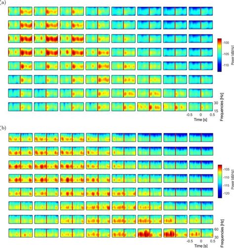 Color Online Mean Spectrogram Maps Of The Epi Array In The Beta Download Scientific Diagram