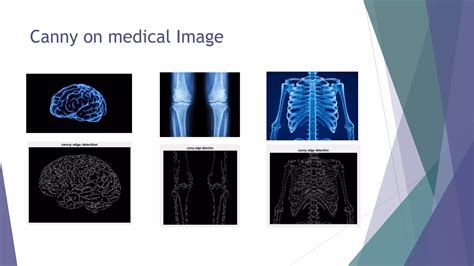 content based medical image retrieval system ppt