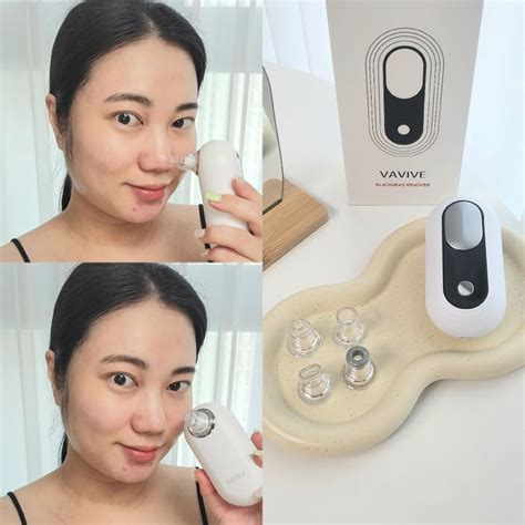 코 피지 제거 흡입 압출기 블랙헤드 없애는 방법 네이버 블로그