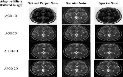 Figure 3 From Development Of Adaptive Gaussian Filter Based Denoising As An Image Enhancement