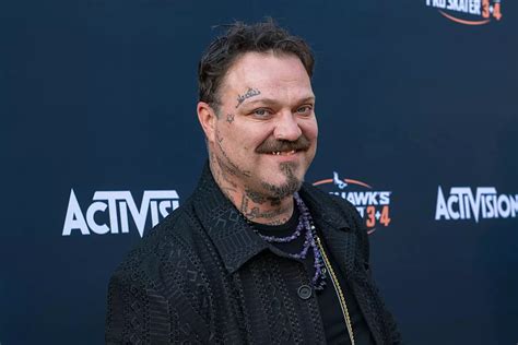 Jackass Bam Margera Admits He Almost Lost Both His Legs After They