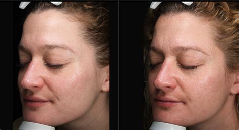 Water For Skin Before And After The 17 Best Face Moisturizers