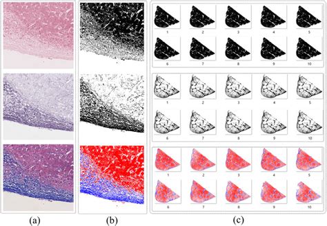 collagen quantification by the color deconvolution with serial wsis of