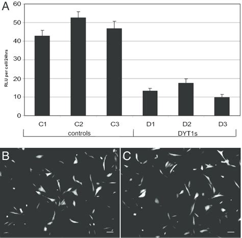 Rate Of Gluc Secretion In Dyt1 Fibroblasts As Compared With Control