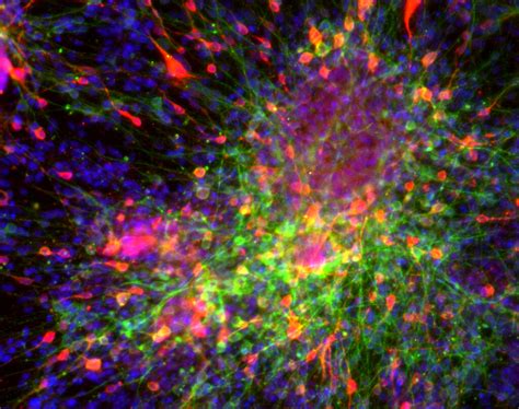 Dopaminergic Neurons Derived From Mouse Embryonic Stem Cells National Institute Of General