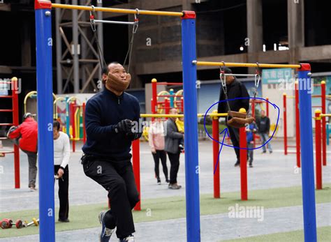 Worried 49 Years Male R Sciatica