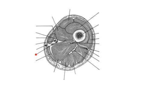 Lower Limb Cross Sections Flashcards Quizlet
