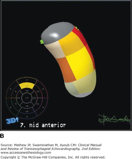 Assessment Of Left Ventricular Systolic Function Anesthesia Key