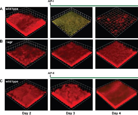 Staphylococcus Aureus Enterotoxin B Ab Ige Acnc Pt Ser Qn Semantic Scholar