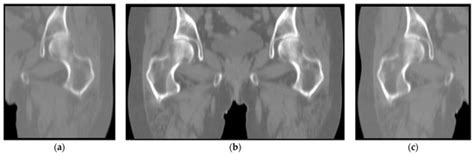 Symmetry Special Issue Multidimensional Signal Processing And Its Applications