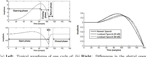 Figure 2 3 From Formant Bandwidth And Resilience Of Speech To Noise Semantic Scholar