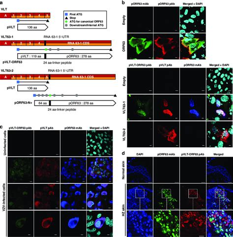 protein coding potential of vlt orf63 fusion transcripts a schematic