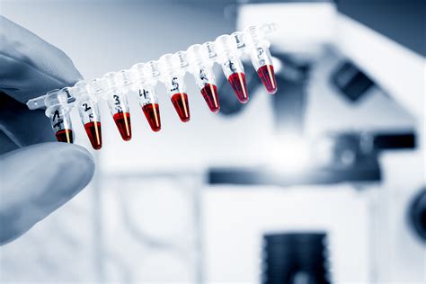 Clinical Trial Is Testing Stem Cells In Scleroderma