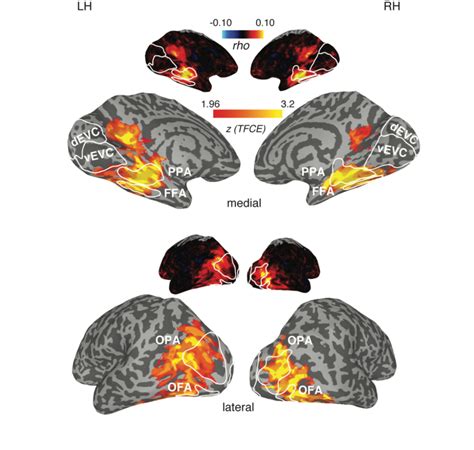 Behavioral Rdm Searchlight Results The Strongest Correlations With The