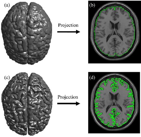 cerebral cortex surface obtained after 3d segmentation of volumetric