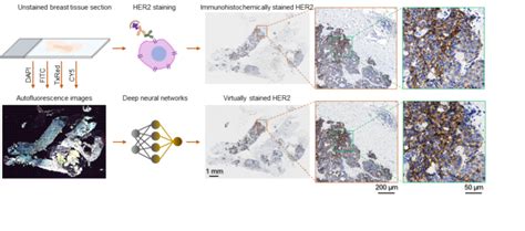 Virtual Her2 Staining Of Unlab [image] Eurekalert Science News Releases
