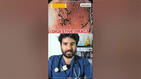 నీళ్ళు అని తాగారు తీరా చూస్తే 😳😳😳dr Vikranth Chunduri Youtube