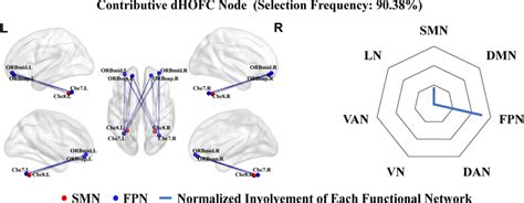 the left panel shows top one discriminative dynamics‐based high‐order
