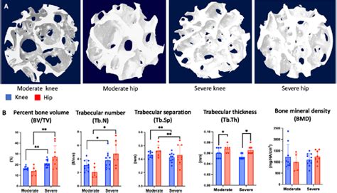 A Reconstructed 3d Models From Synchrotron Radiation X Ray Download Scientific Diagram