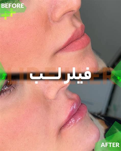 ‎دکتر علی رضوانی پزشک زیبایی‎ Dralirezvanii • Instagram Photos And