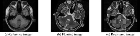 Figure 1 From Brain Mr Multimodal Medical Image Registration Based On