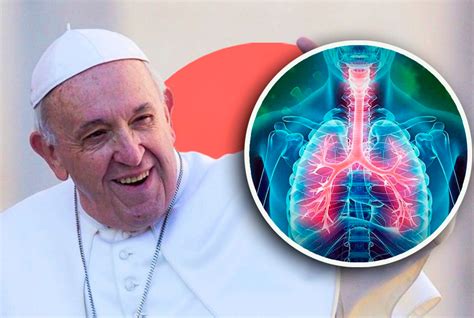 Papa Francisco Presenta Cuadro Infeccioso Respiratorio Rcr Peru