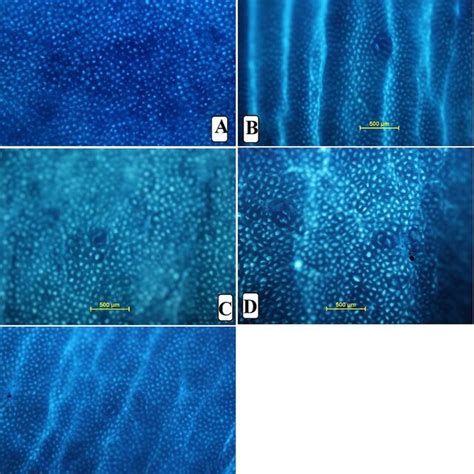 Microscopic Views Of Cross Sectioned Colon Tissues In Rats A Normal Download Scientific