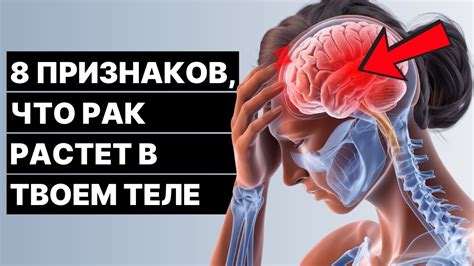 Ранние признаки рака которые нельзя игнорировать Симптомы и профилактика Youtube