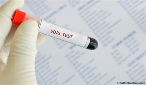 What Is A Vdrl Test Procedure Purpose Results Interpretation