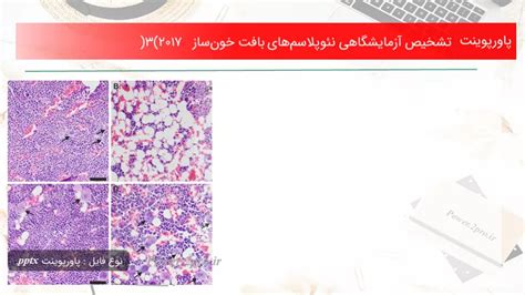 دانلود پاورپوینت تشخیص آزمایشگاهی نئوپلاسم‌های بافت خون‌ساز 2017 3