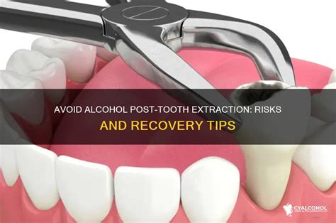 Avoid Alcohol Post Tooth Extraction Risks And Recovery Tips Cyalcohol